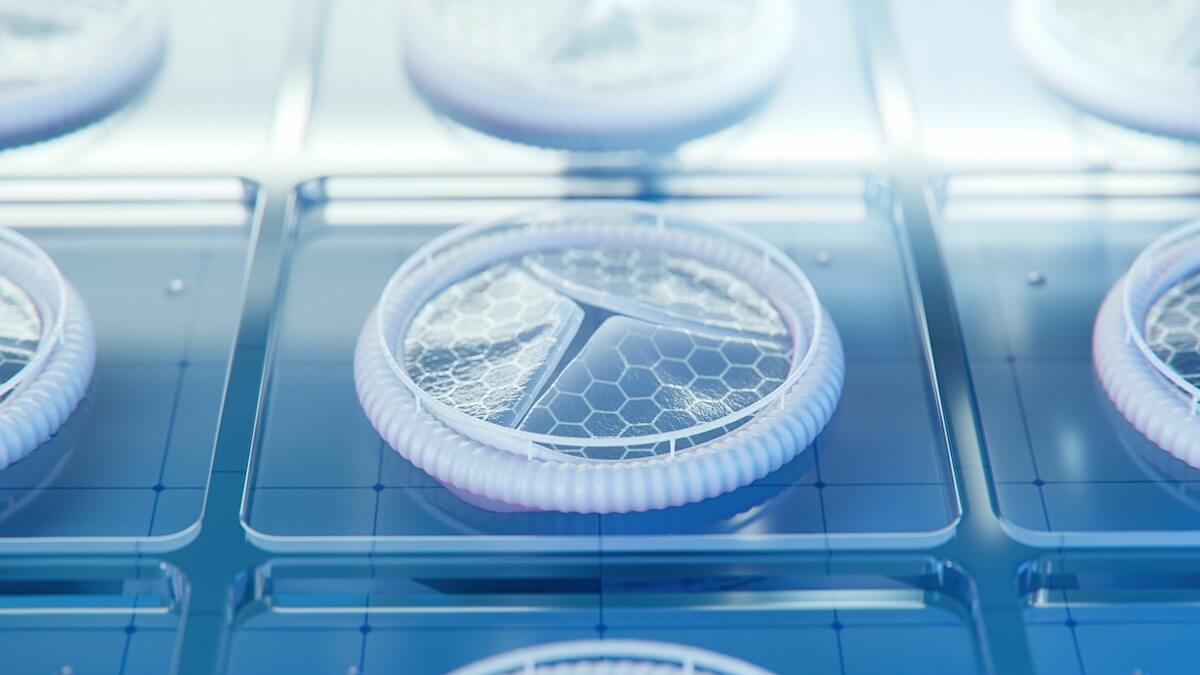 Best Practices: Material/Supplier Selection under the EFS IDE Framework ...