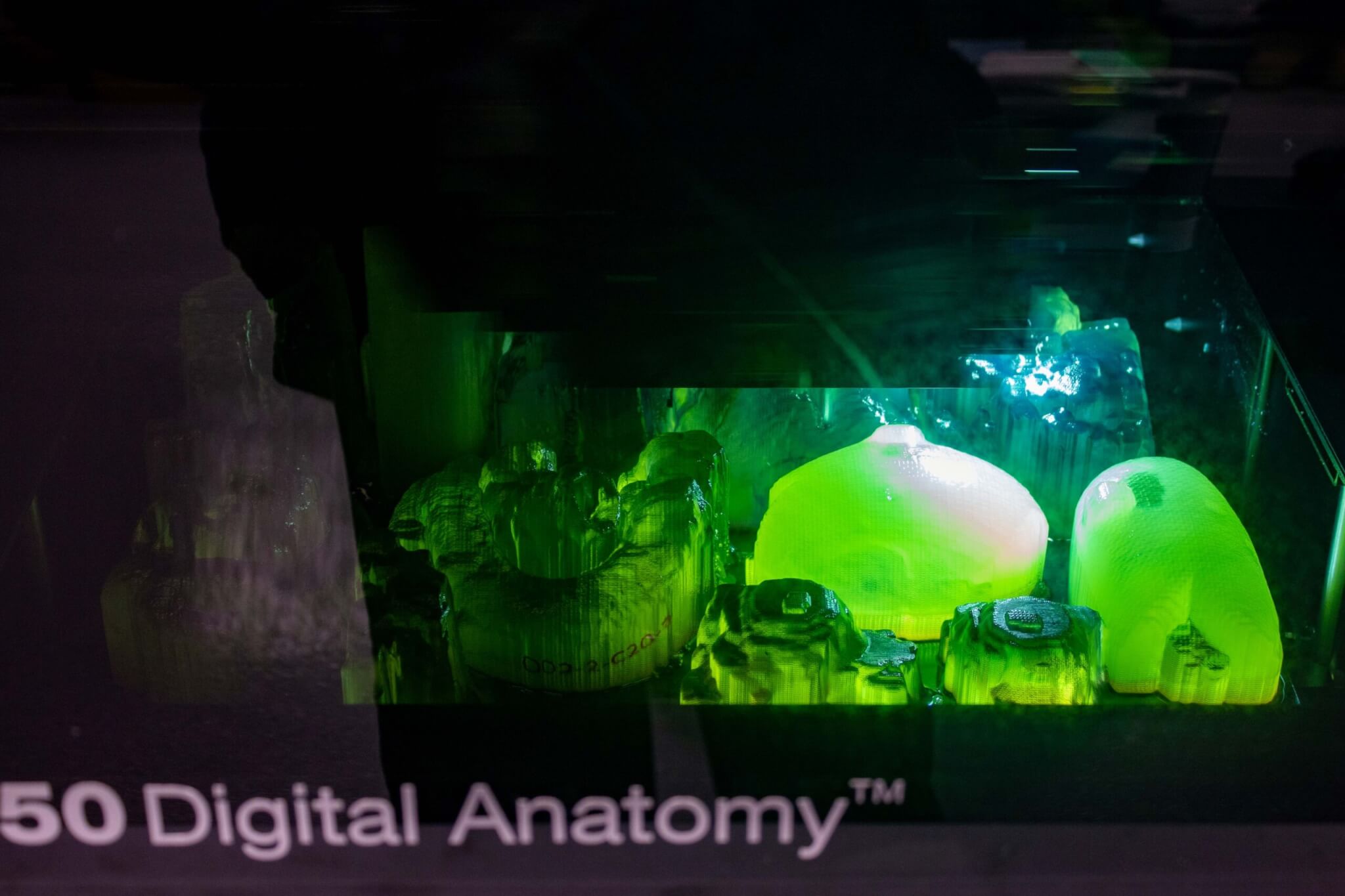 Case Study: Point-of-Care 3D Printing for Personalized Medical Devices ...